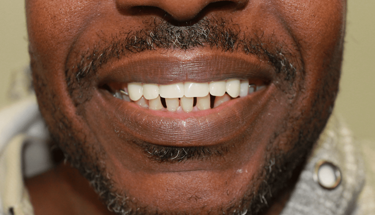 Denture Gallery - Woodside Denture Centre